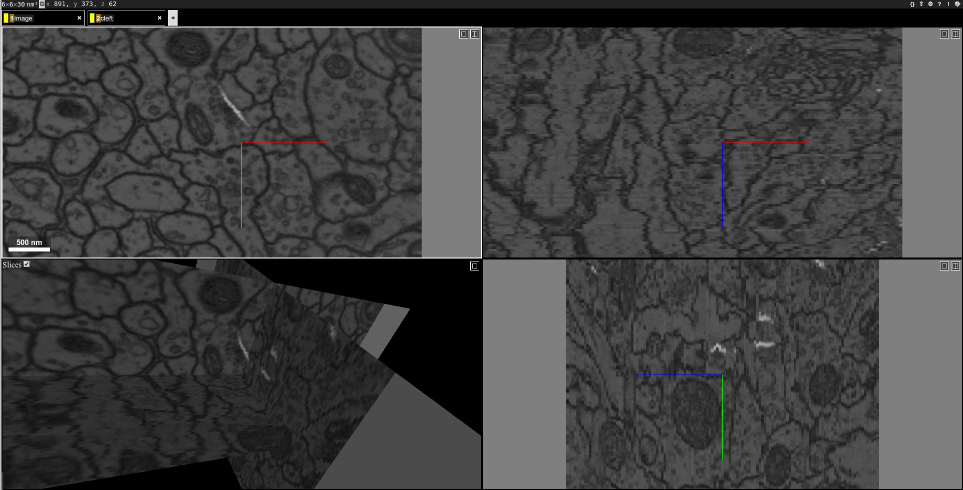Tutorial — chunkflow 0.0.0 documentation